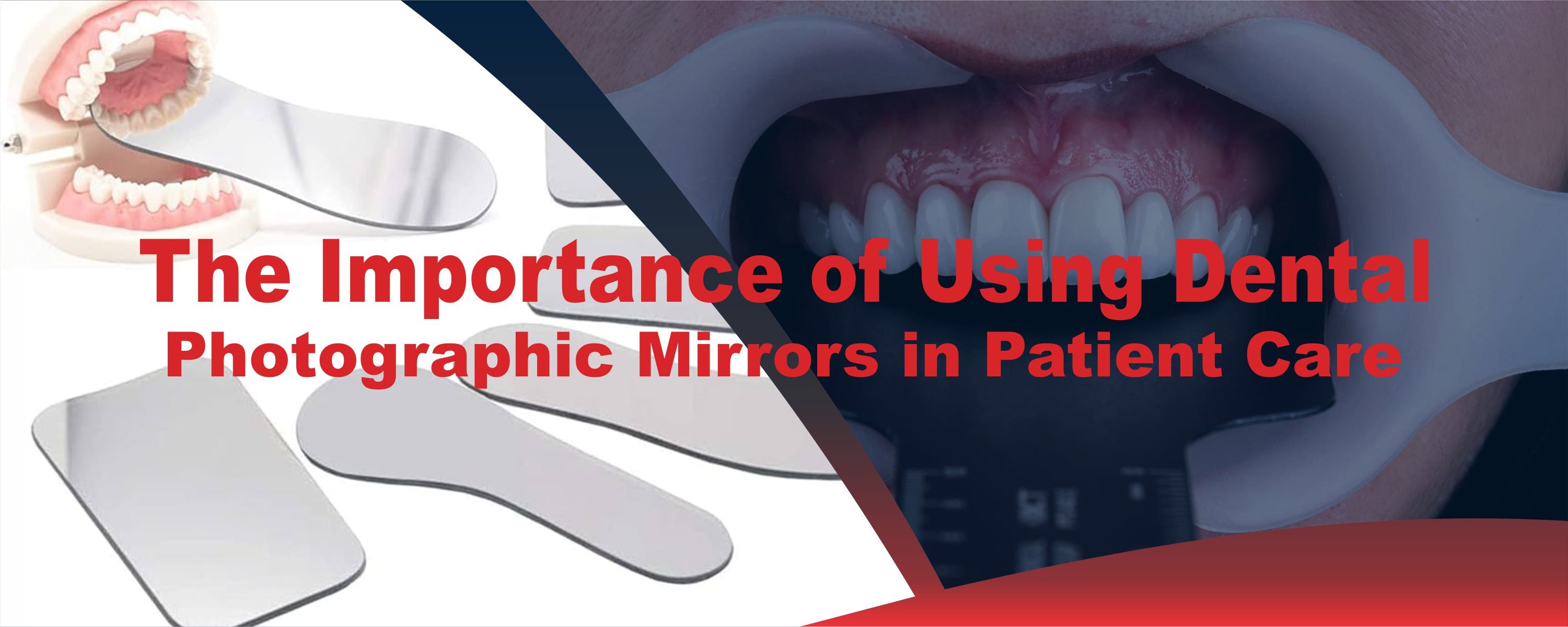 Importance of Using Dental Photographic Mirrors in Patient Care